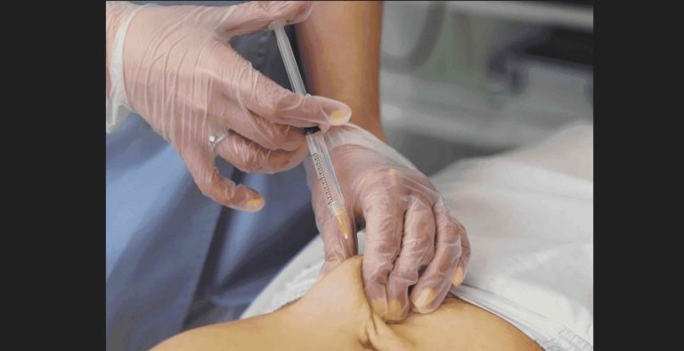 How Fat Dissolving Injections for Legs Work: A Complete Guide